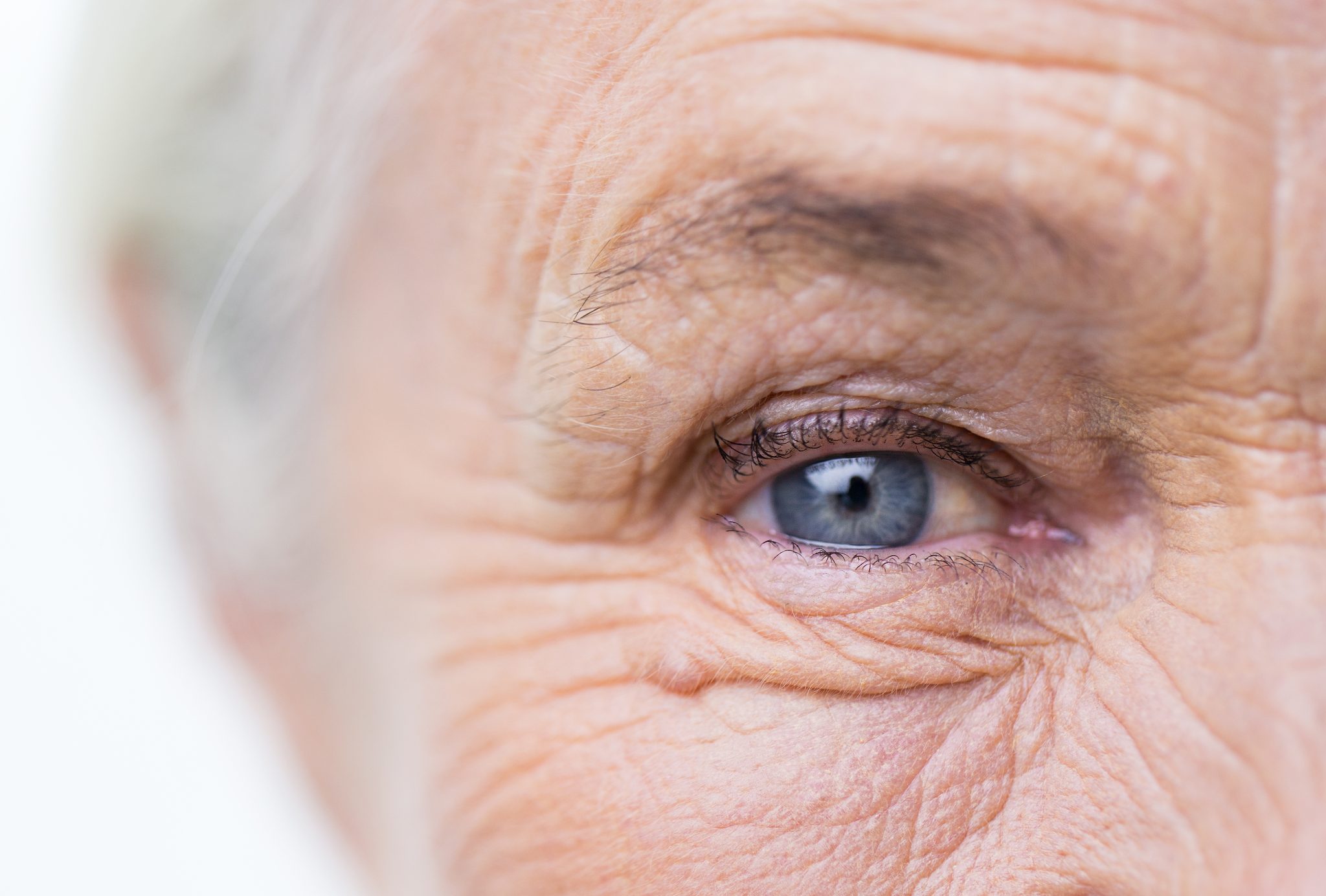 Elder Care: Understanding Drooping Eyelids in Seniors